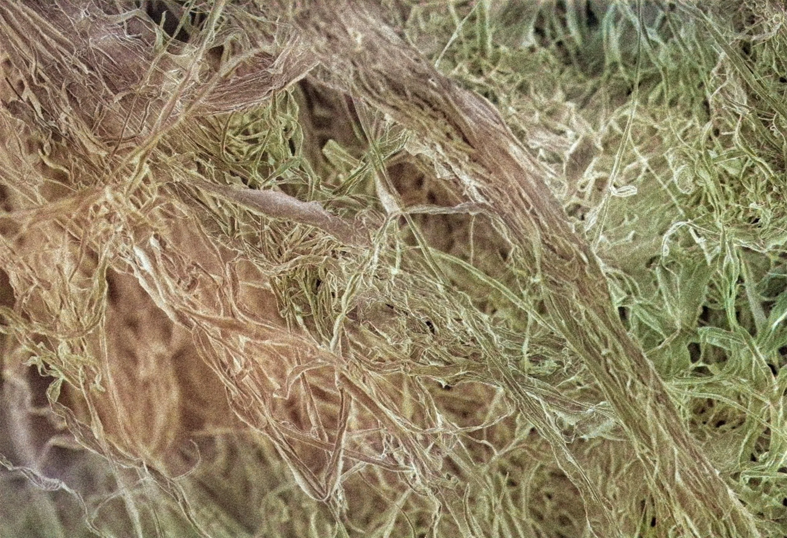 Lithuanian scientists develop cellulose - Kaunas University of ...